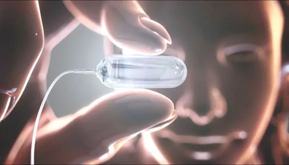 Obalon - An Easy Pill to Swallow | Living Magazine